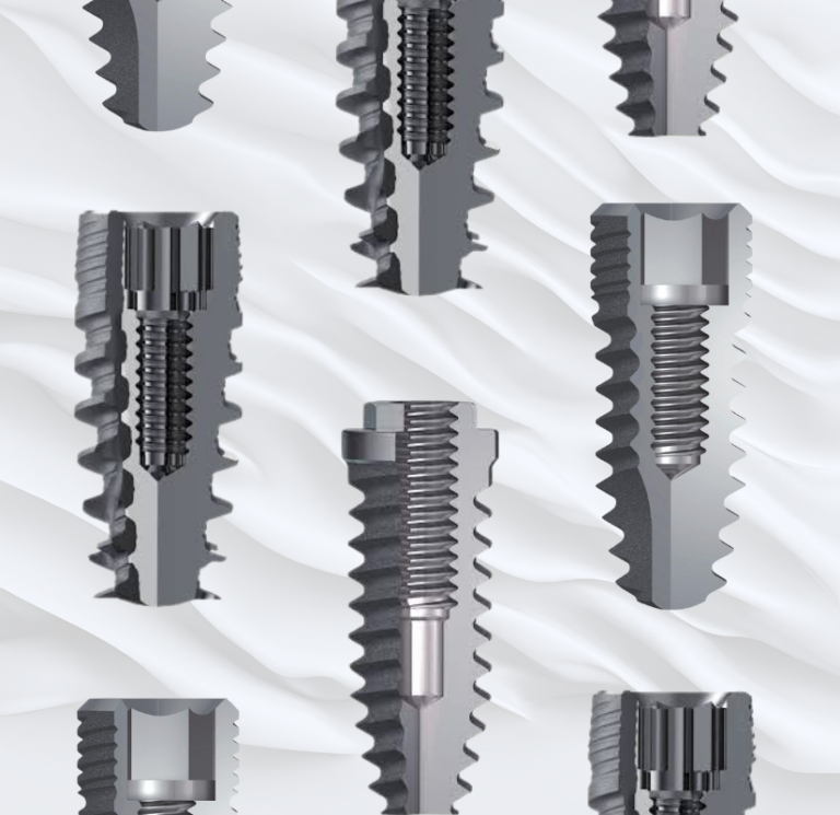 KEYS TO IDENTIFY AN IMPLANT - GT-Medical Blog