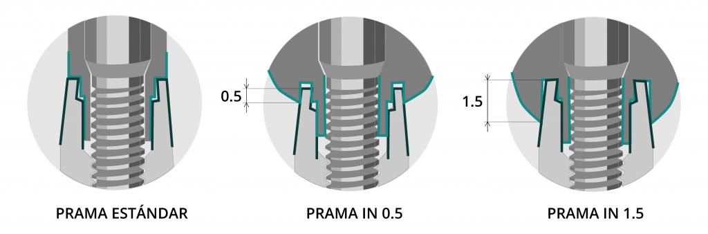 SWEDEN & MARTINA - PRAMA IMPLANTS - GT-Medical Blog