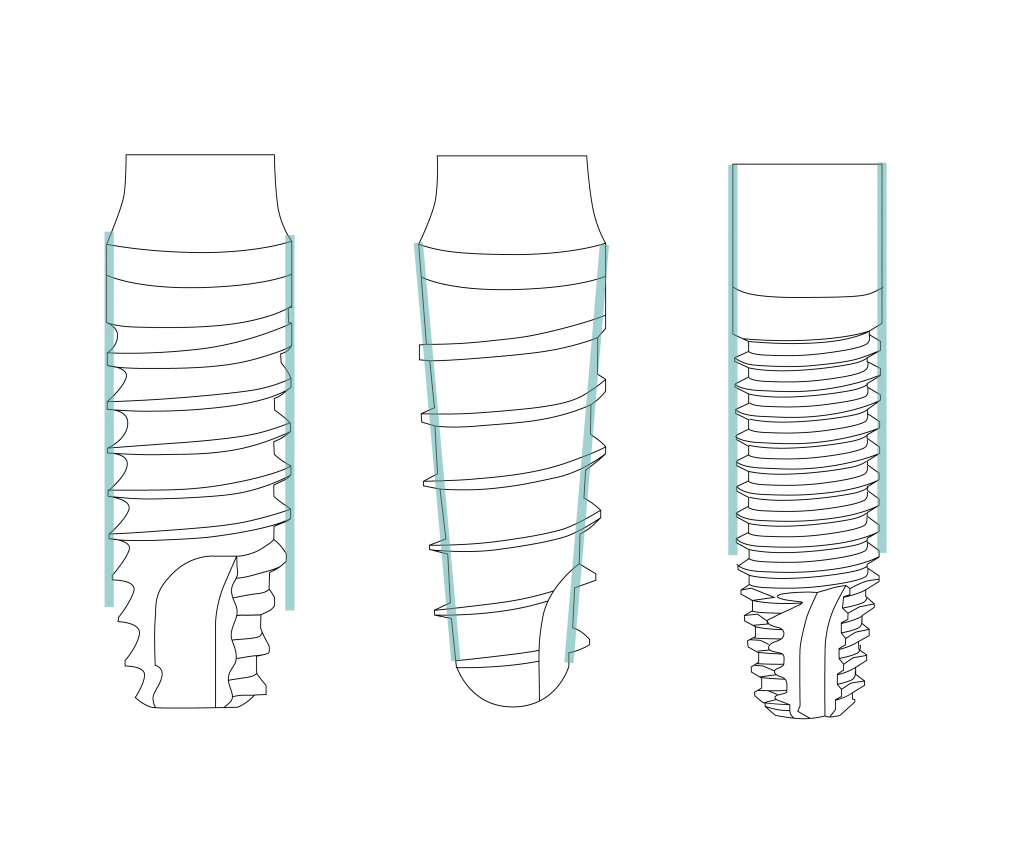 SWEDEN & MARTINA - PRAMA IMPLANTS - GT-Medical Blog