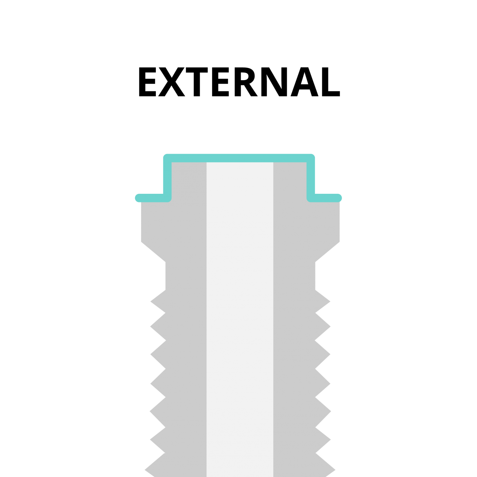 IMPLANT IDENTIFICATION CHARACTERISTICS - THE CONNECTION - GT-Medical Blog