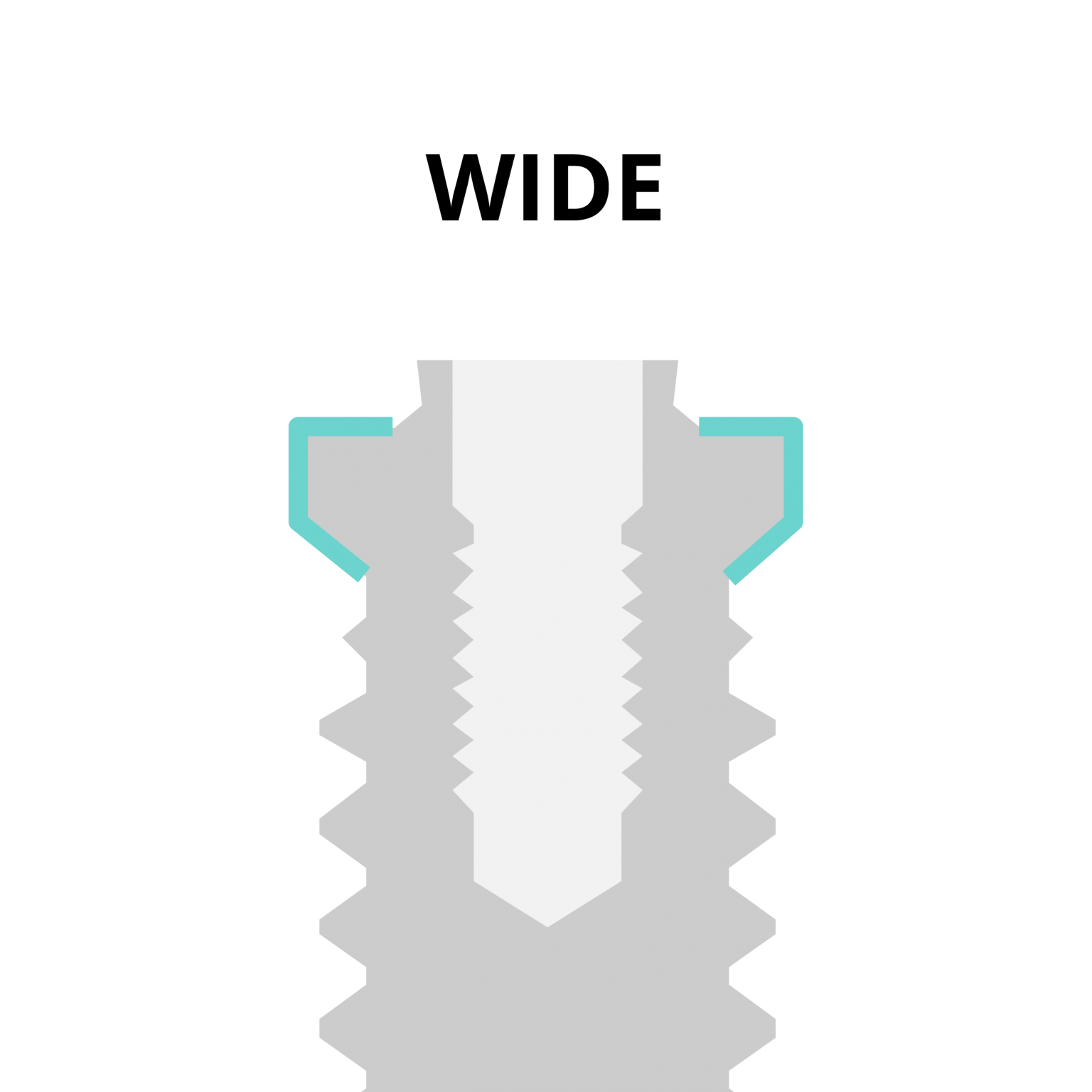 IMPLANT IDENTIFICATION CHARACTERISTICS - THE COLLAR - GT-Medical Blog