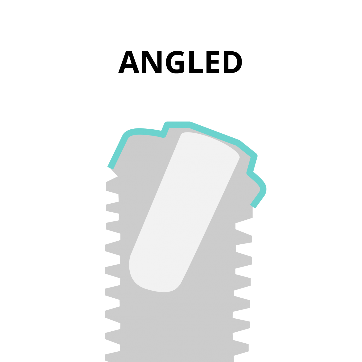 IMPLANT IDENTIFICATION CHARACTERISTICS - THE COLLAR - GT-Medical Blog