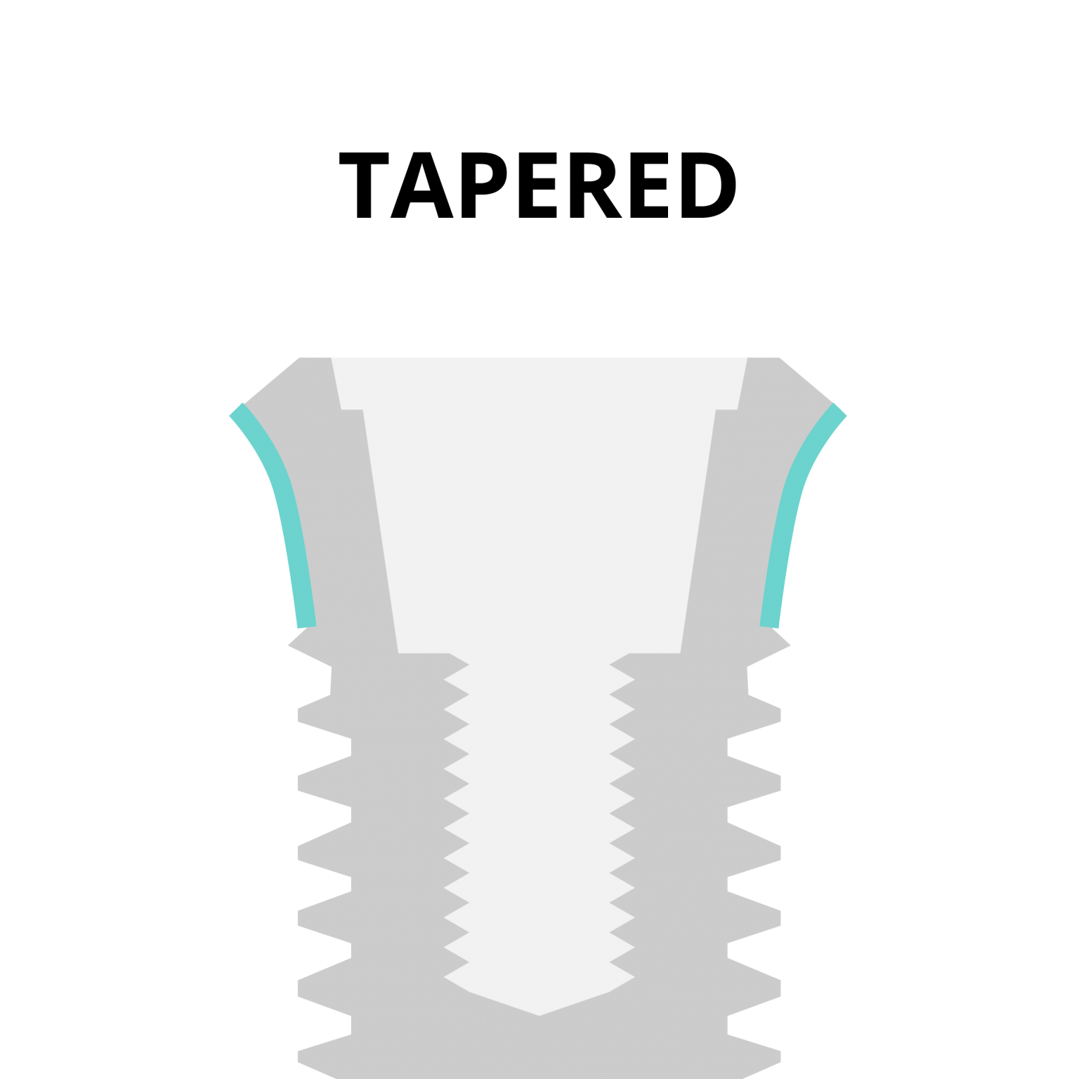 IMPLANT IDENTIFICATION CHARACTERISTICS - THE COLLAR - GT-Medical Blog