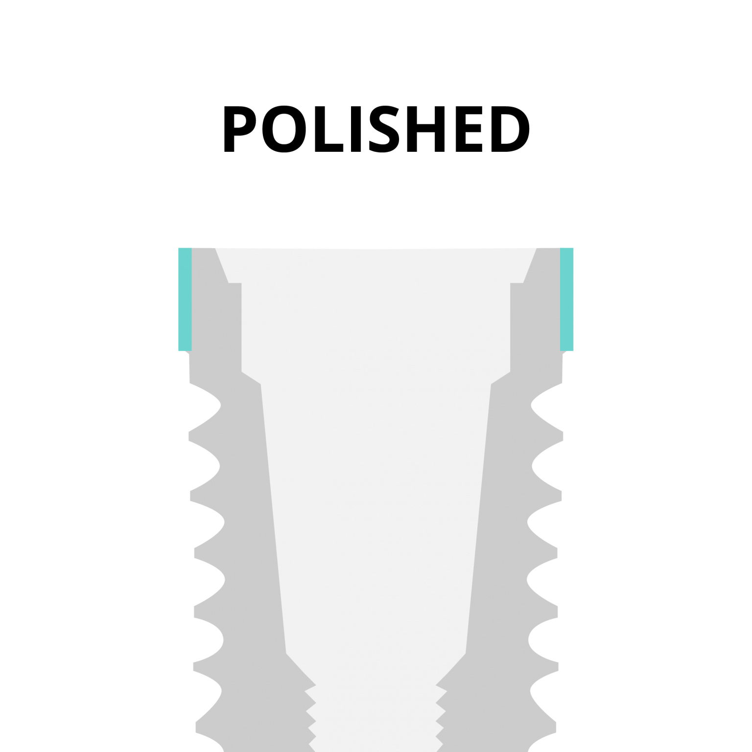 IMPLANT IDENTIFICATION CHARACTERISTICS - THE COLLAR - GT-Medical Blog