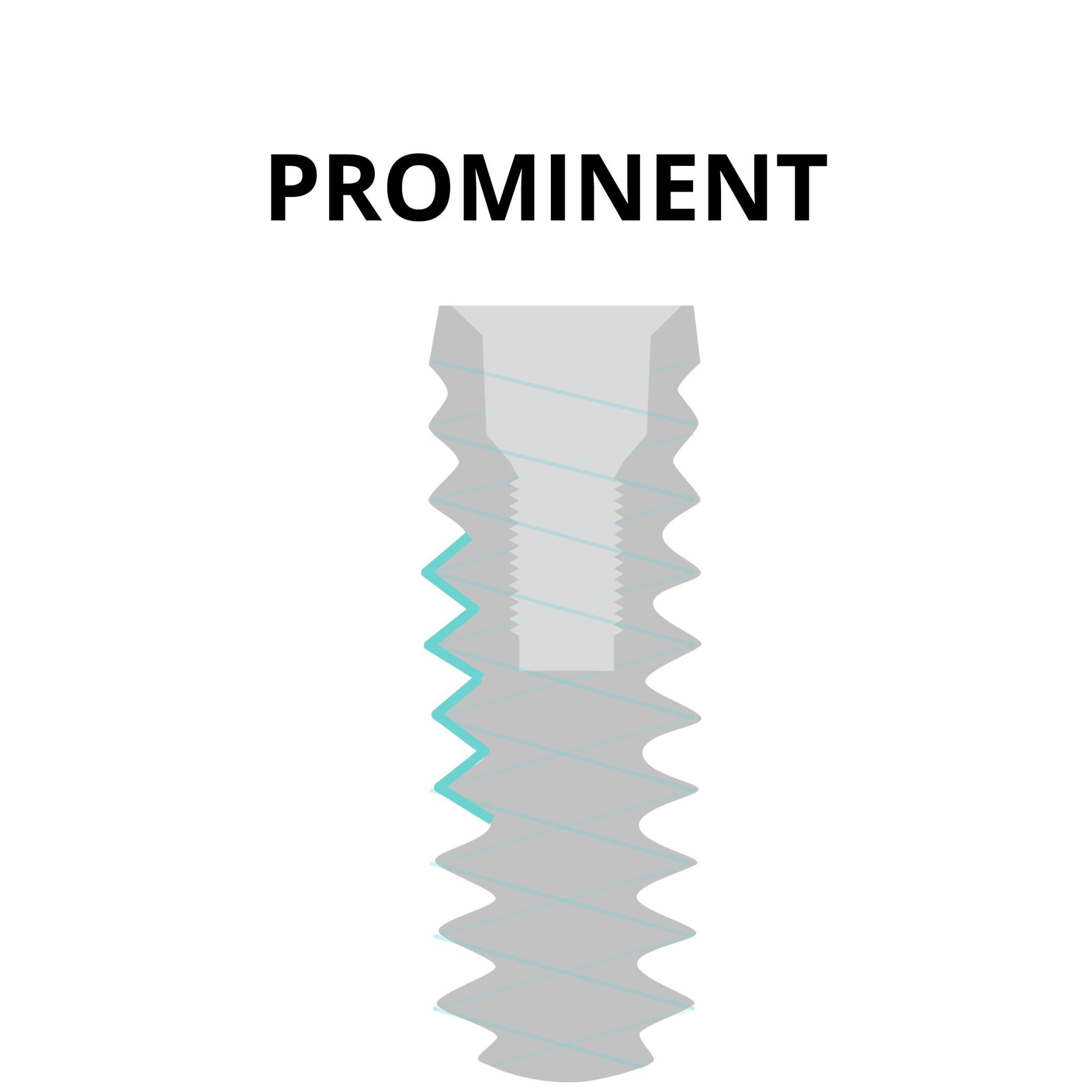IMPLANT IDENTIFICATION CHARACTERISTICS - THE BODY - GT-Medical Blog