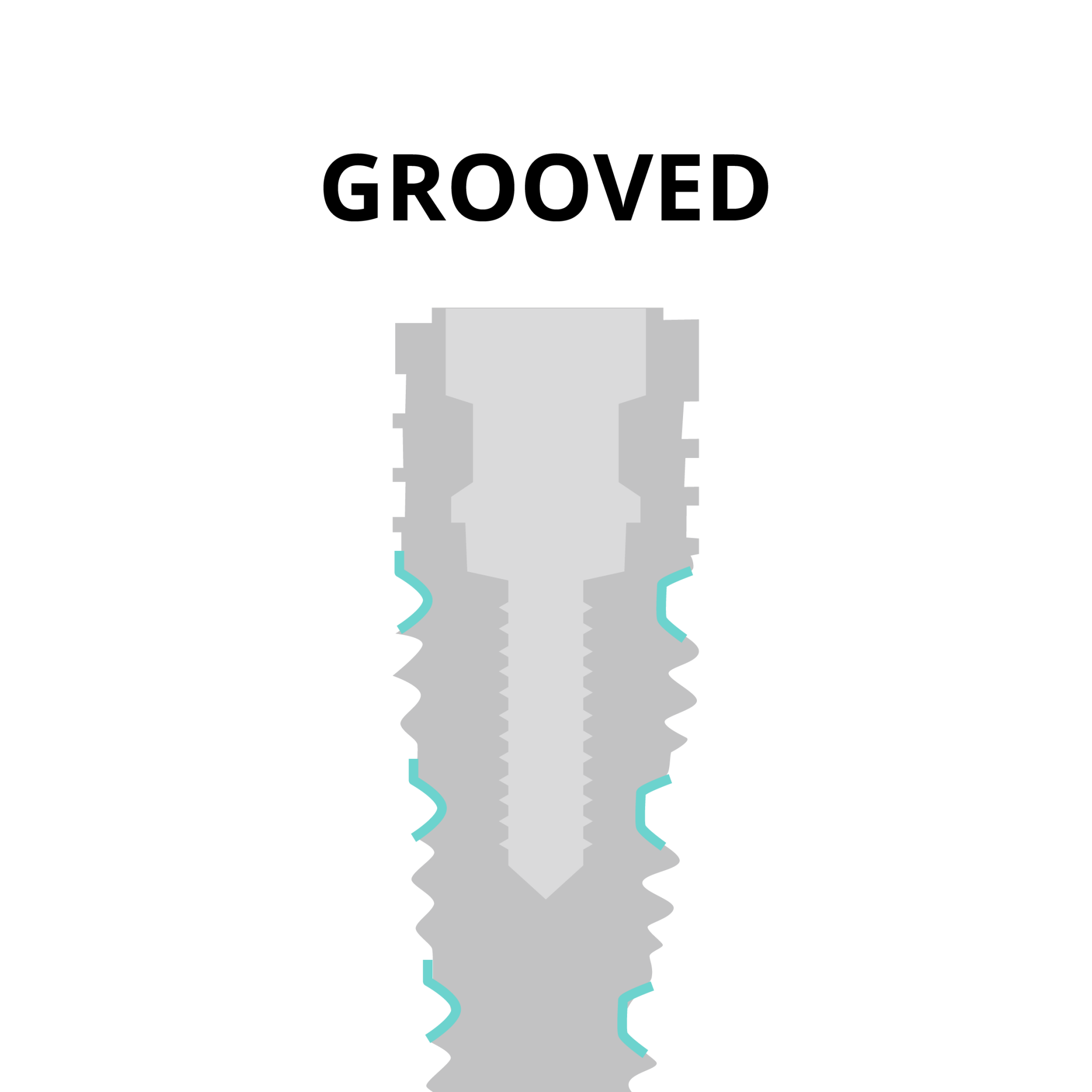 IMPLANT IDENTIFICATION CHARACTERISTICS - THE BODY - GT-Medical Blog
