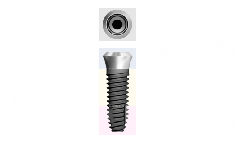 IMPLANT IDENTIFICATION CHARACTERISTICS - THE BODY - GT-Medical Blog